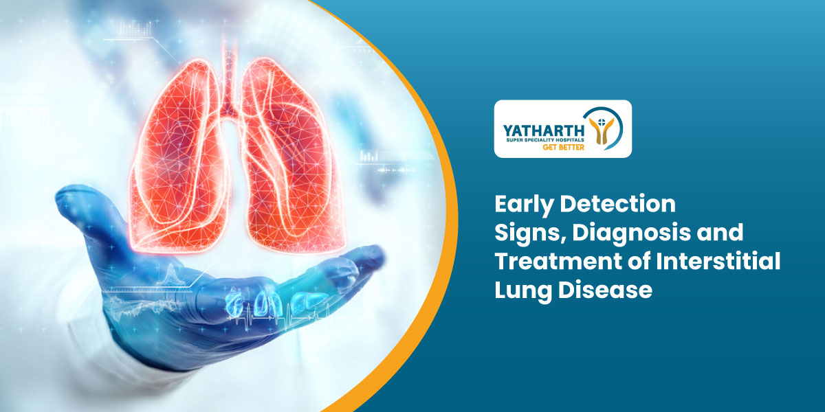 Pleural Diseases: Diagnosis, Treatment & Recovery Options