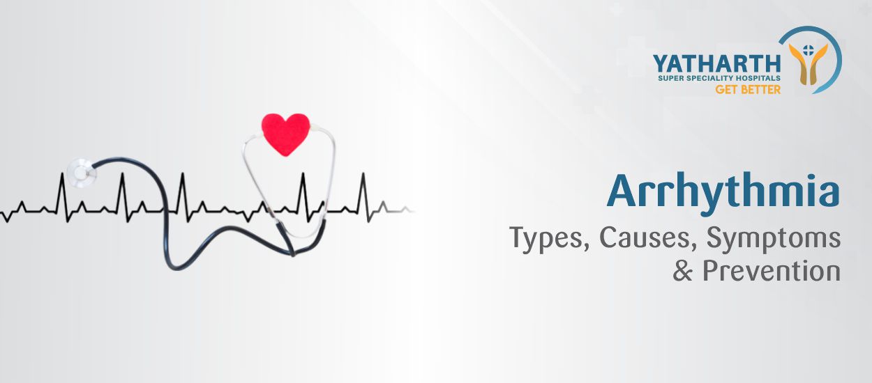 Arrhythmia: Types, Causes, Symptoms & Prevention | Heart Rhythm ...