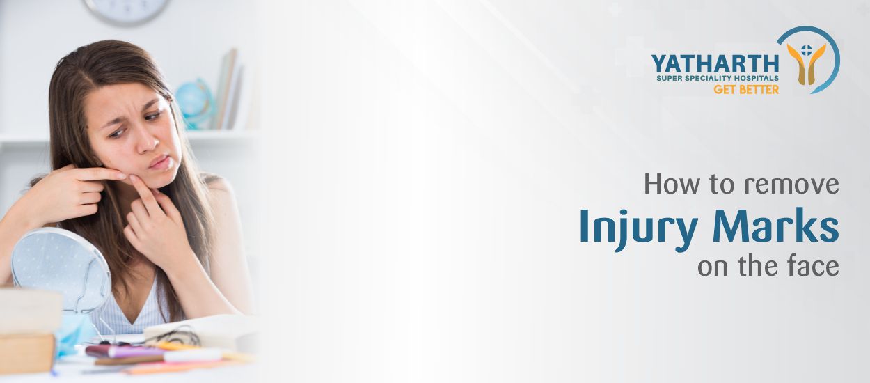 How to remove injury marks on the face - Yatharth Hospitals