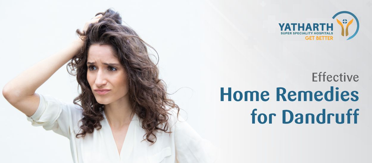Dandruff Causes, Home Remedies & Dermatologist Advice | Yatharth Hospital