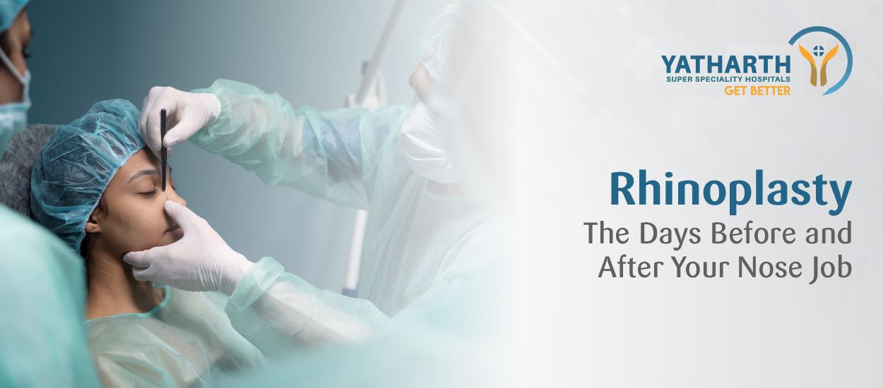 Rhinoplasty: Nose Job Recovery, Healing & Results Timeline
