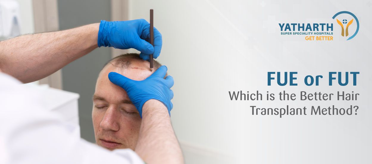 FUE vs FUT: Best Hair Transplant Method | Yatharth Hospital